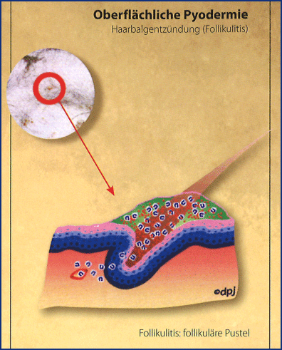 Bakterielle Hautinfektion